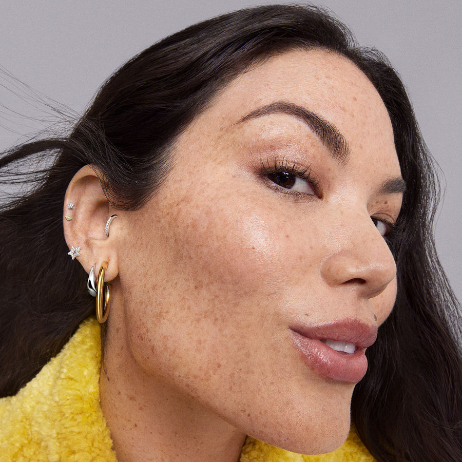 Hypertrophic Scars & Bumps From Ear Piercing | Rowan